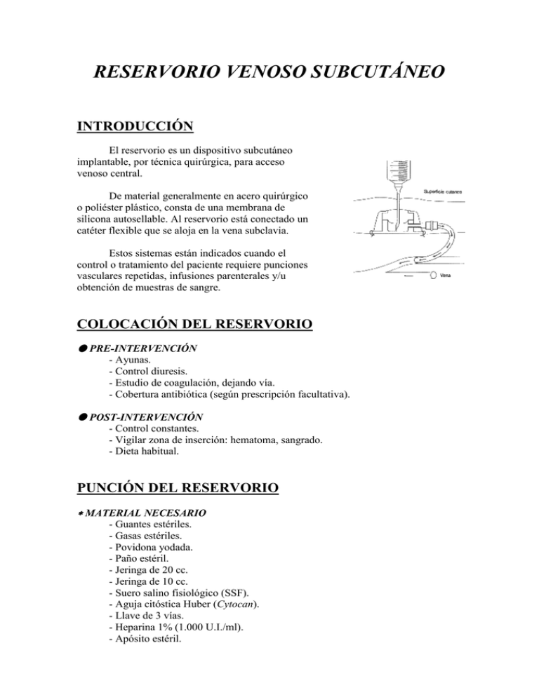 RESERVORIO VENOSO SUBCUTÁNEO