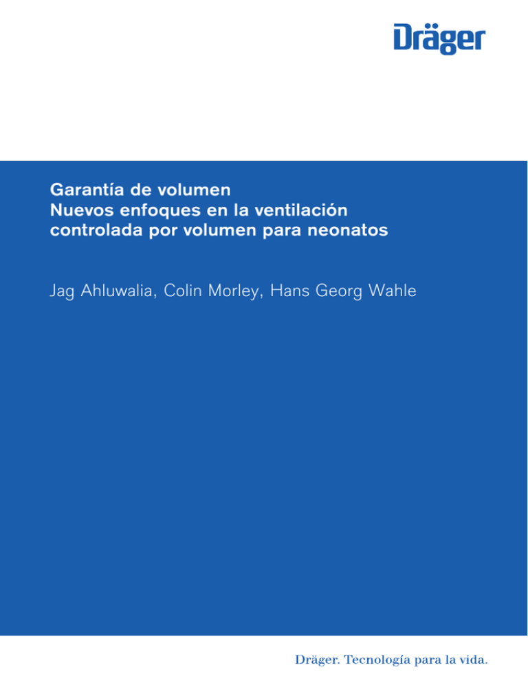 Garantía de volumen