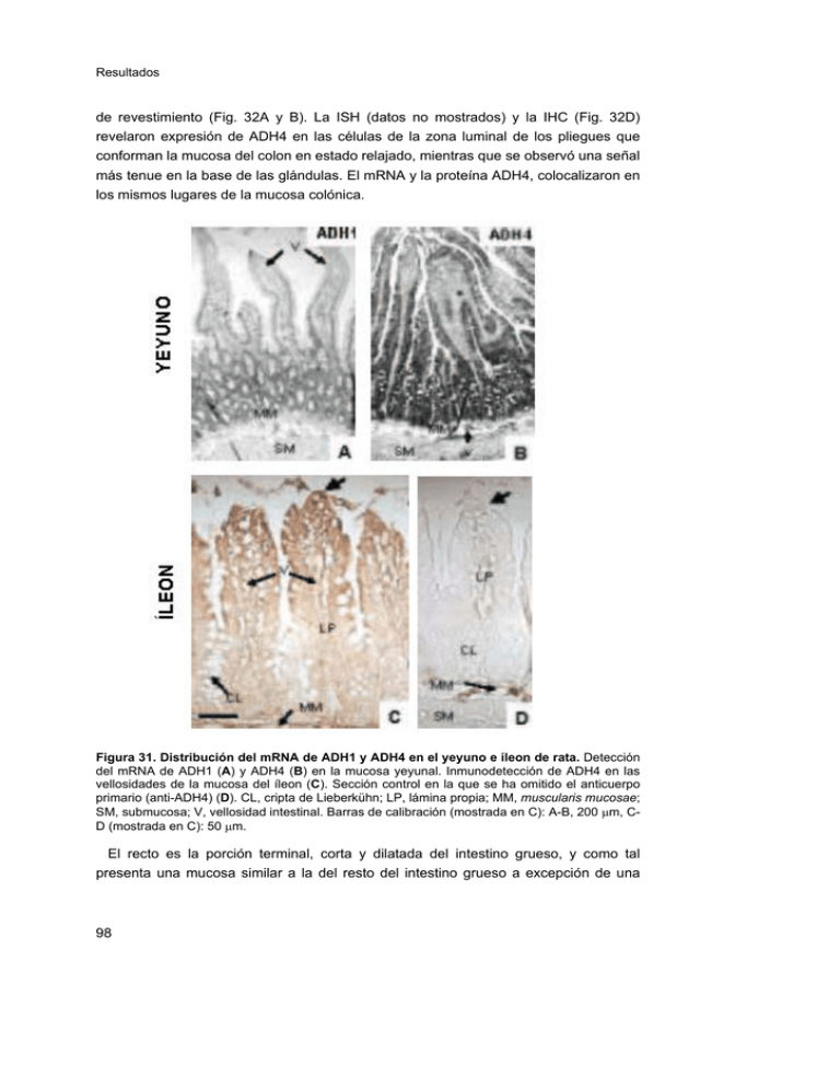 Distribución de las alcohol deshidrogenasas ADH1 y ADH4 en