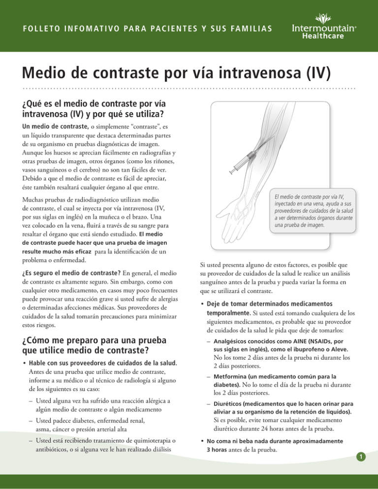 Medio de contraste por vía intravenosa (IV)