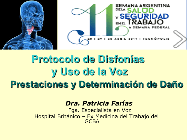 disfonía