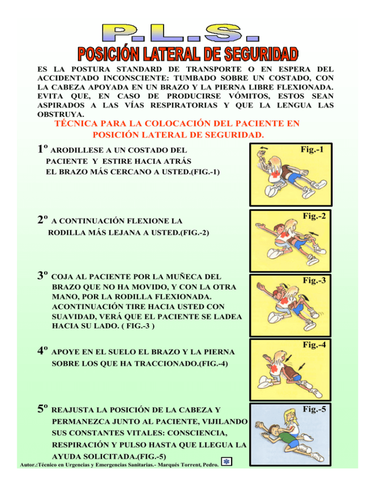 técnica para la colocación del paciente en posición lateral de