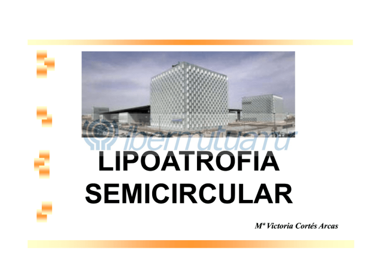 lipoatrofia lipoatrofia semicircular semicircular