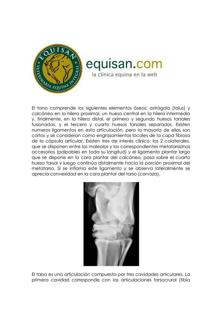 El tarso comprende los siguientes elementos óseos: astrágalo (talus