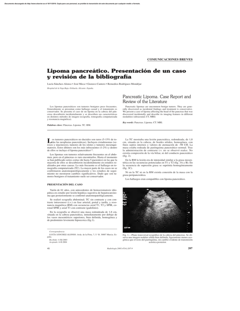 Lipoma pancreático. Presentación de un caso y revisión de la