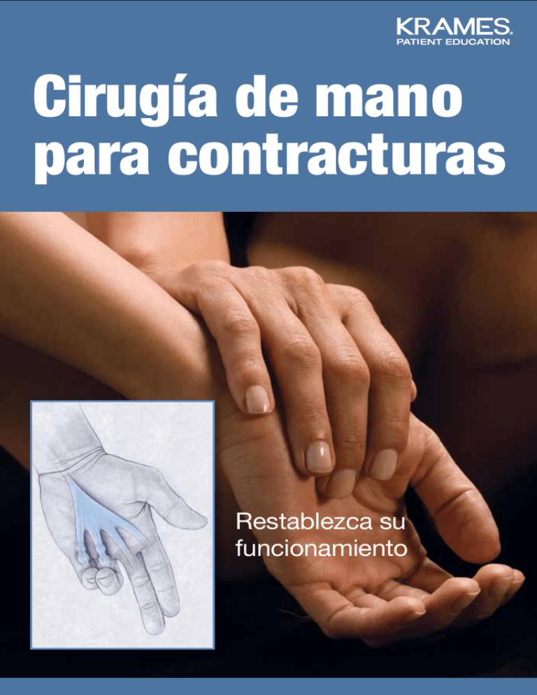 Cirugía de mano para contracturas