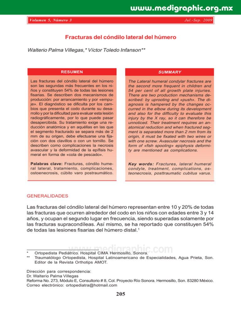 Fracturas del cóndilo lateral del húmero