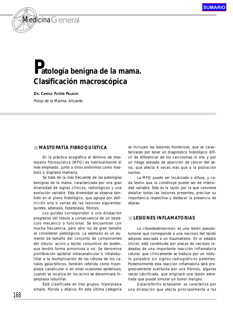 168 Patología benigna de la mama. Clasificación microscópica