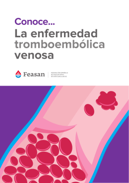 Flebitis migratoria y trombosis venosa profunda de repetición