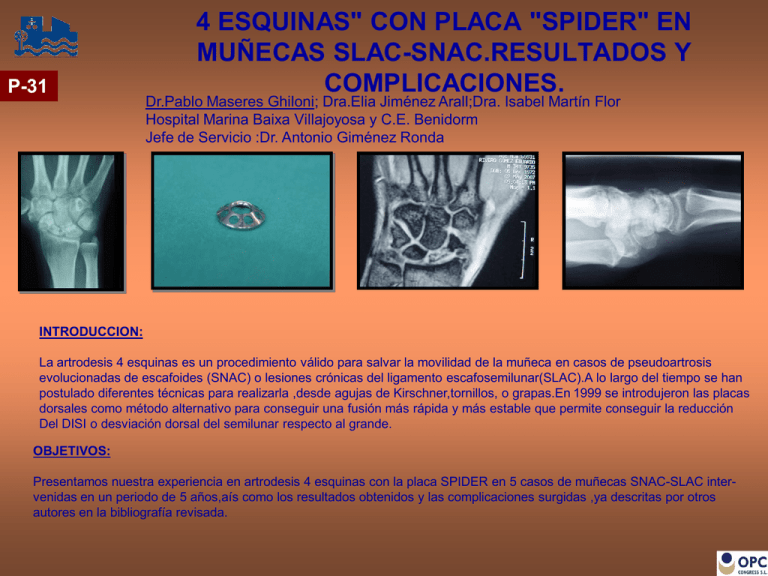 4 esquinas" con placa "spider" en muñecas slac-snac