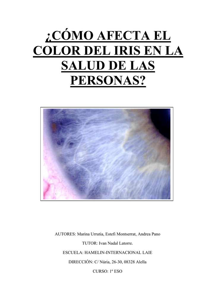 como afecta el color del iris en la salud