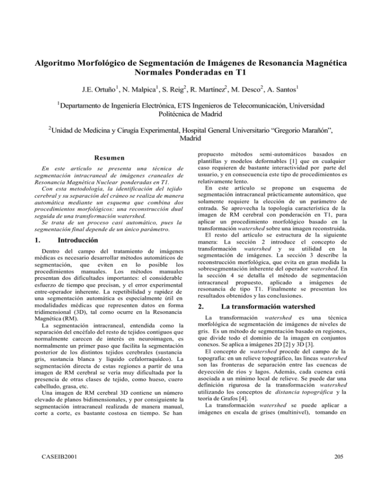 Algoritmo Morfológico de Segmentación de Imágenes - DIE