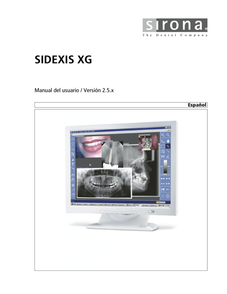 SIDEXIS XG