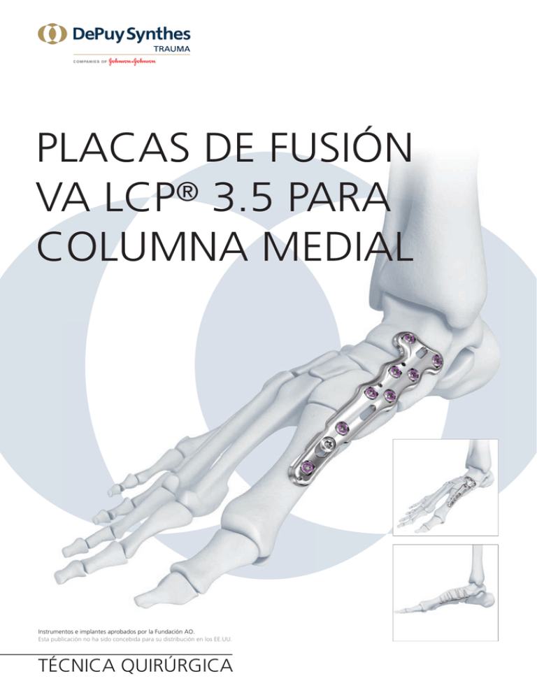 PLACAS DE FUSIÓN VA LCP® 3.5 PARA COLUMNA MEDIAL