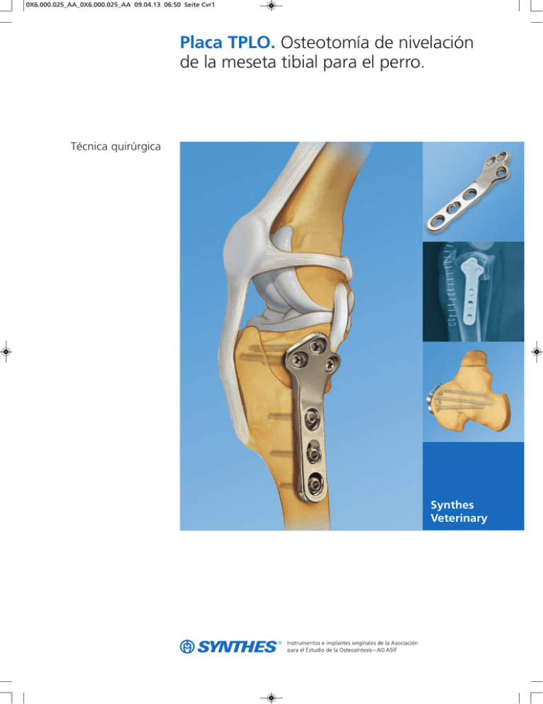 Placa TPLO. Osteotomía de nivelación de la meseta tibial
