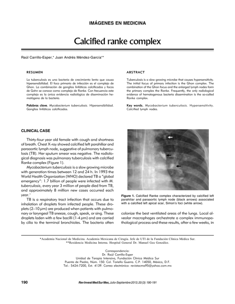 Calcified ranke complex
