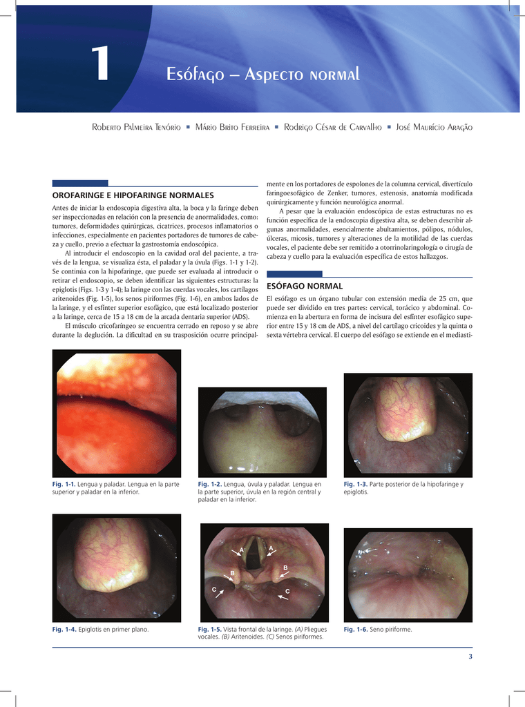 1 Esófago – Aspecto normal