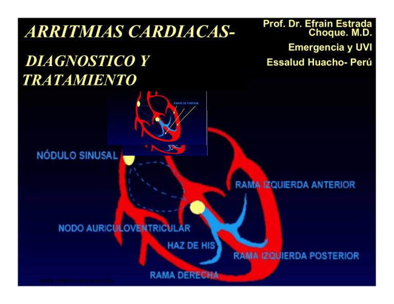 Arritmias Cardiacas
