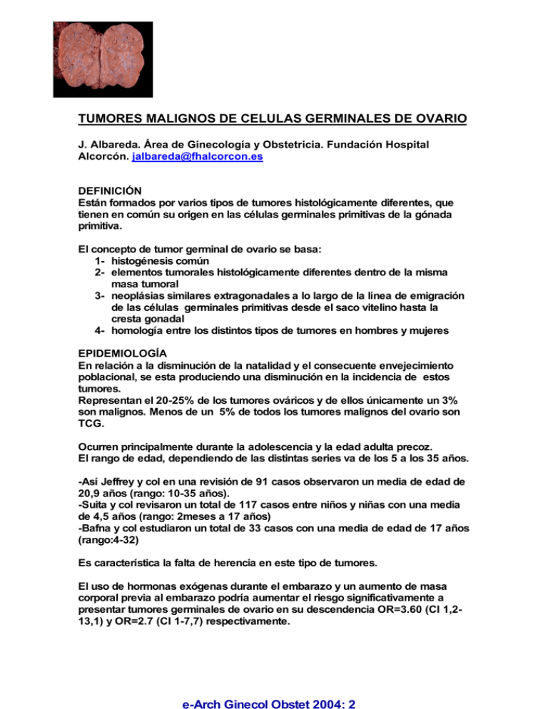 Tumores malignos de células germinales de ovario. - e