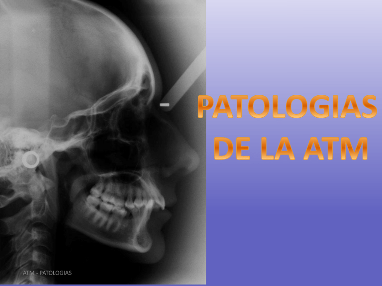 PATOLOGIAS DE ATM