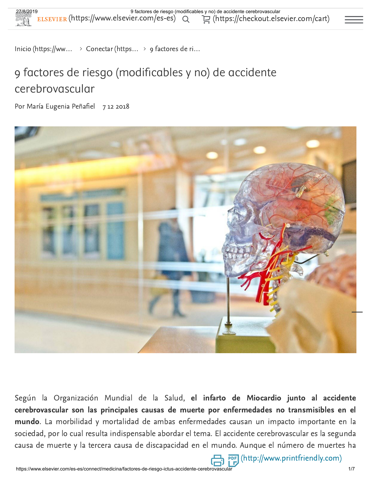 9 factores de riesgo (modificables y no) de accidente cerebrovascular