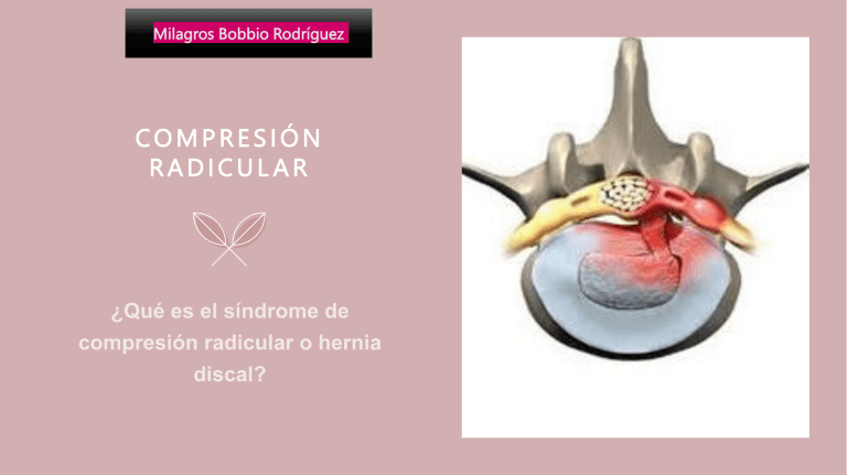 Compresión radicular tarea