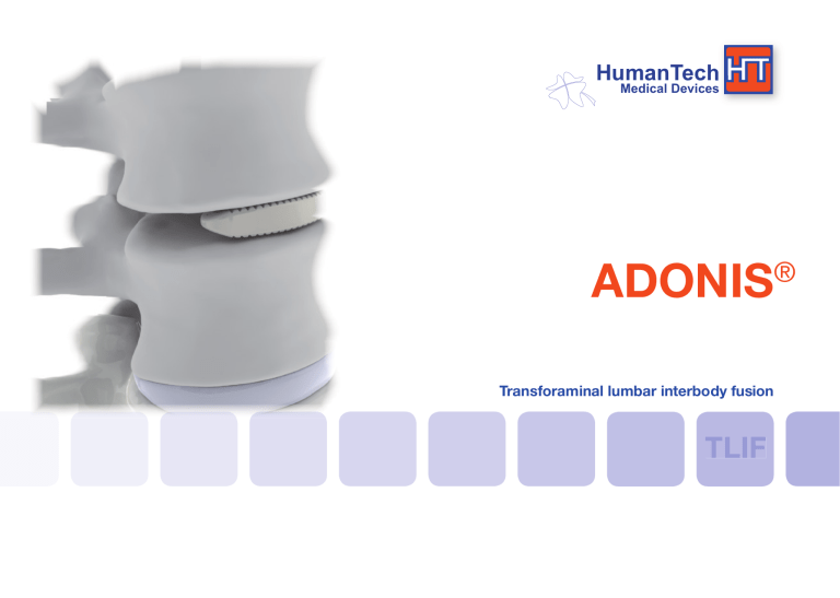 adonis tlif en 20170421 web