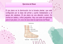 Ejercicios de Risser para Pie Plano: Guía Completa