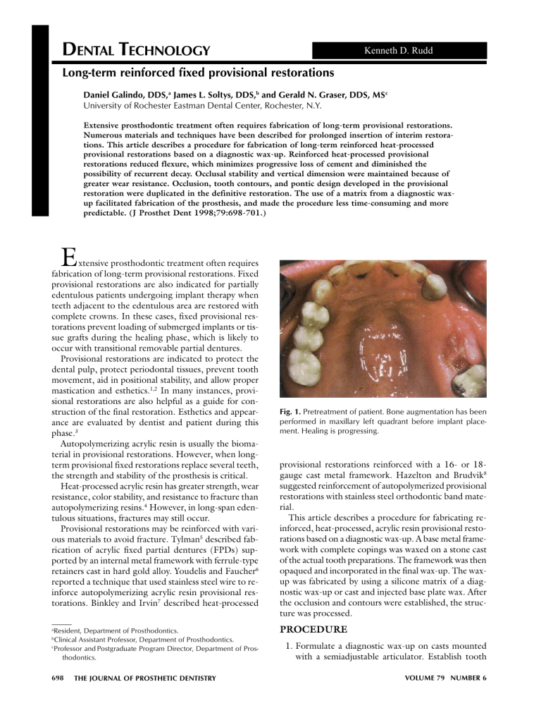 Reinforced Provisional Restorations: A Dental Technique