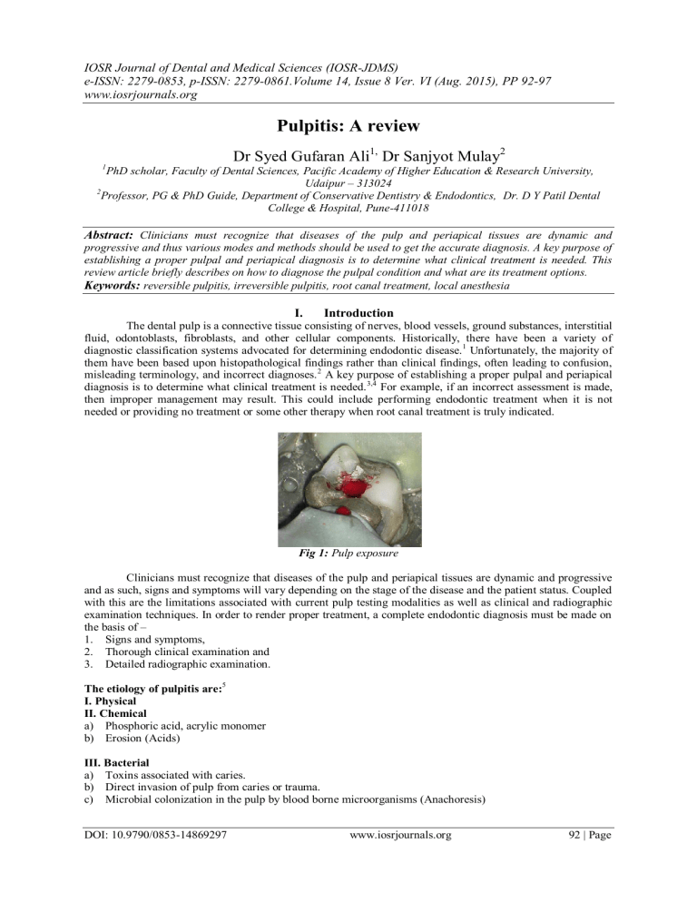 Pulpitis: Diagnosis and Treatment Review